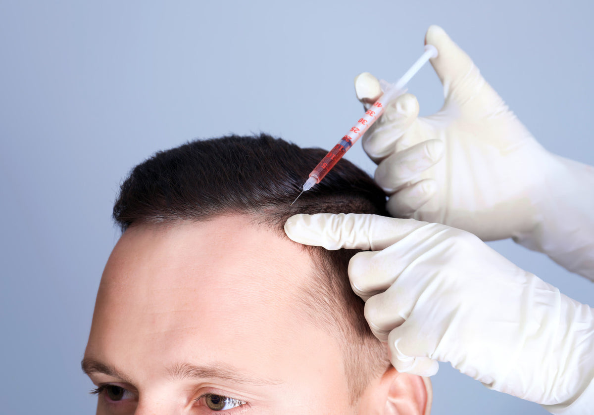 PRF Hair Rejuvenation– The Cure Medical Aesthetics